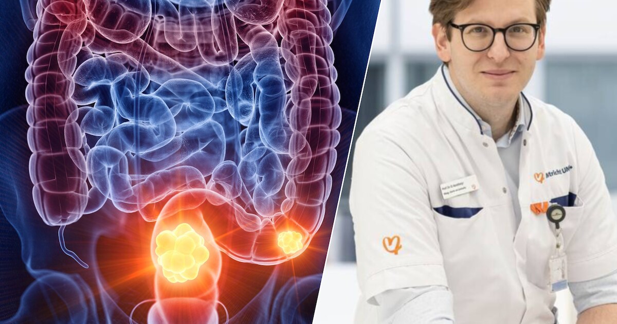 Hoe ontstaat darmkanker? ‘Het kan zo’n 15 jaar duren tot poliep ...